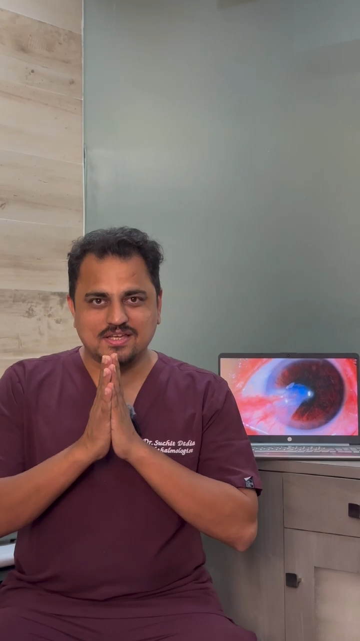 Advanced Pterygium Surgery in Ahmedabad | 16+ Years Expertise